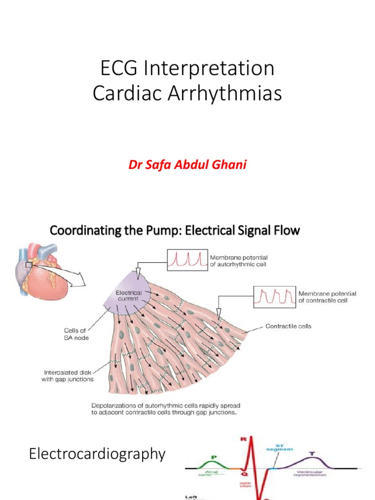 ECG Interpretation | PDF | Electrocardiography | Heart