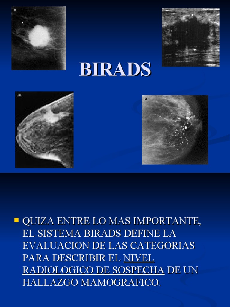 8 Birads | PDF | Mammography | Neoplasms