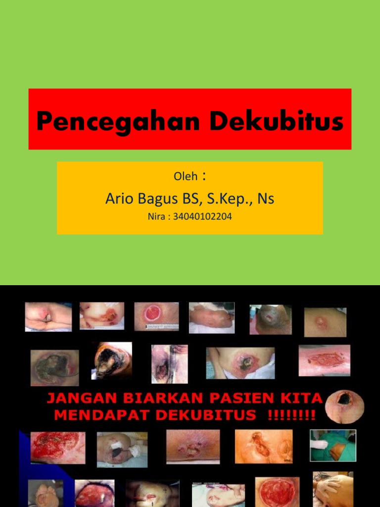 Pencegahan Dekubitus | PDF