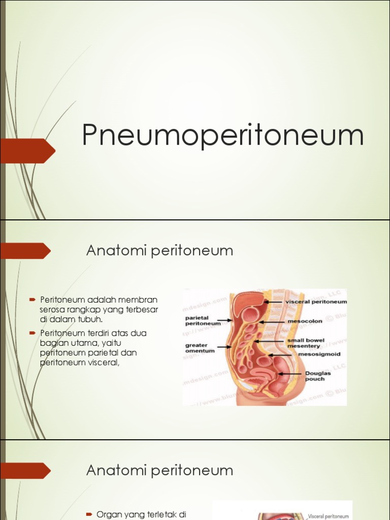 Pneumoperitoneum | PDF