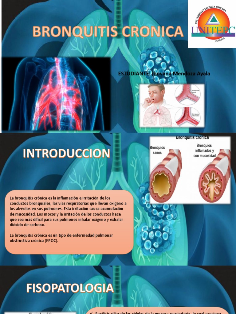 Bronquitis Crónica | PDF | Pulmón | Tos