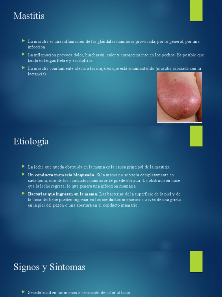 Mastitis | PDF | Pecho | Cáncer de mama