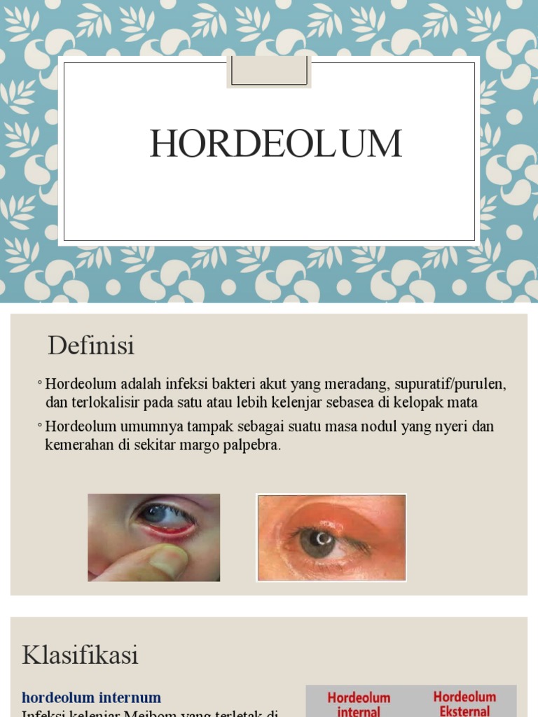 Hordeolum & Kalzion | PDF