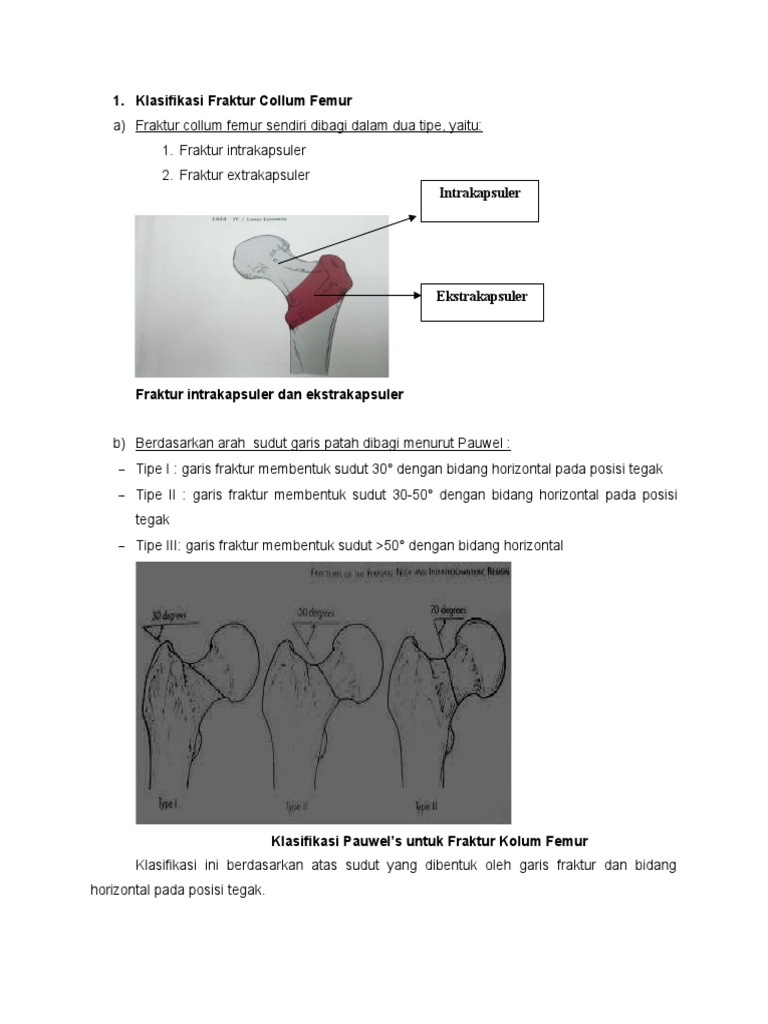 Klasifikasi Fraktur Collum Femur | PDF
