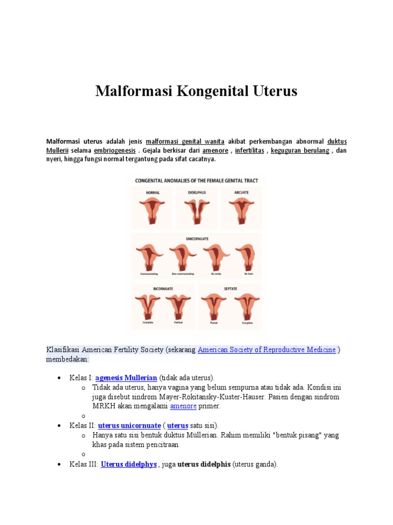 Malformasi Kongenital Uterus | PDF