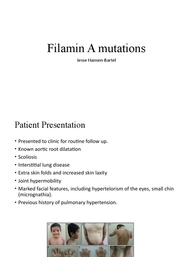 Filamin A Mutations: Jesse Hansen-Bartel | PDF | Cardiology | Actin