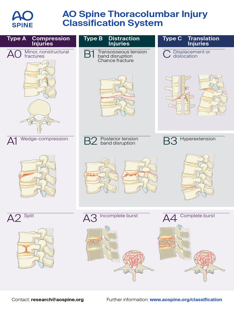 AOS Injury Classification Pocket Card THORACOLUMBAR | PDF | Spinal Cord ...