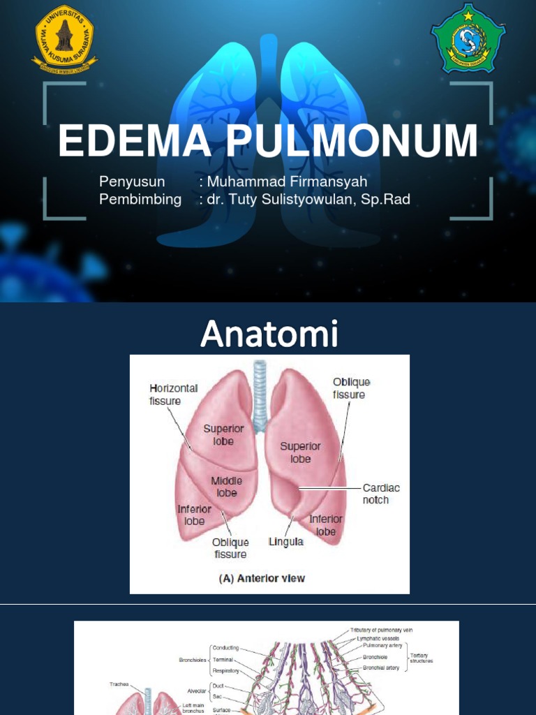 Edema Pulmonum Fix | PDF