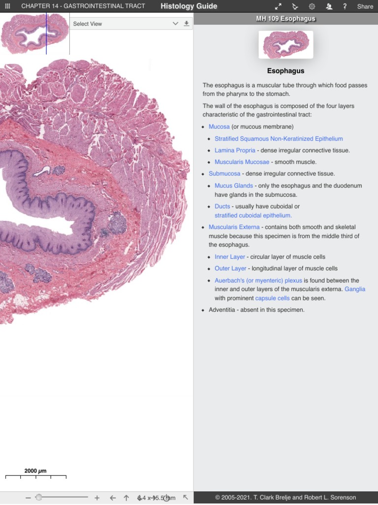 Esophagus Gastrointestinal Tract | PDF | Esophagus | Gastrointestinal Tract