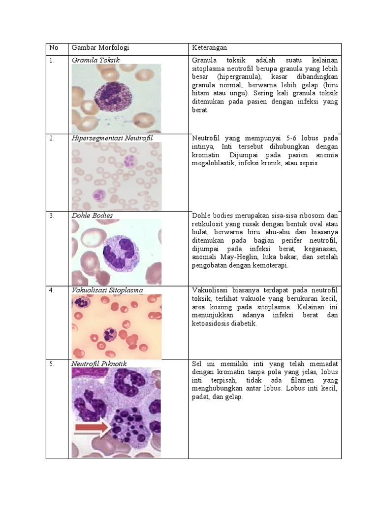 Kelainan Leukosit | PDF