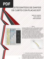 Técnica Quirúrgica Placa Philos: Conceptos | PDF | Tornillo | Metalurgia