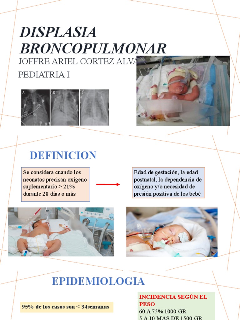 Displasia Broncopulmonar | PDF