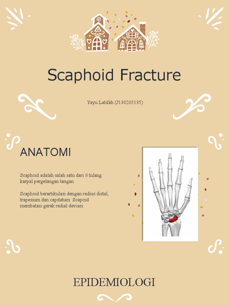 Presus Scaphoid Fracture | PDF