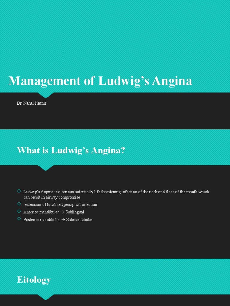 Management of Ludwig's Angina | PDF | Medical Specialties | Clinical ...
