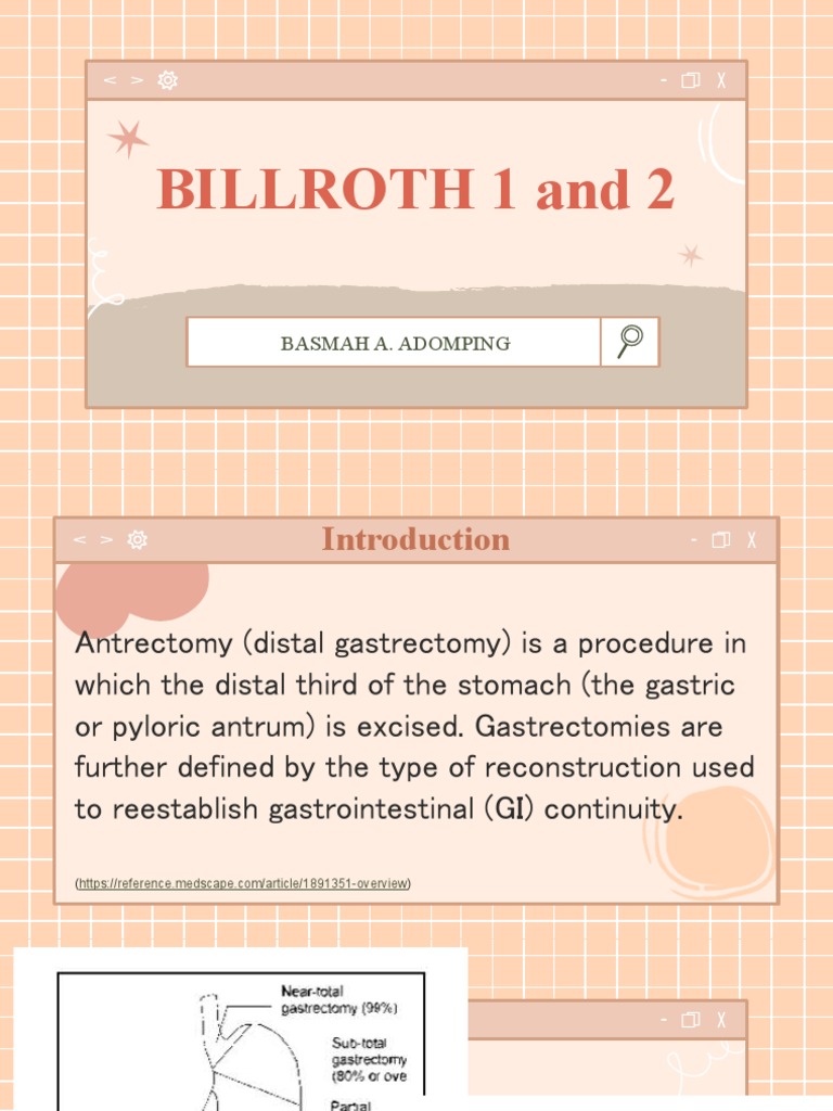 Difference Between Billroth I And Billroth Ii