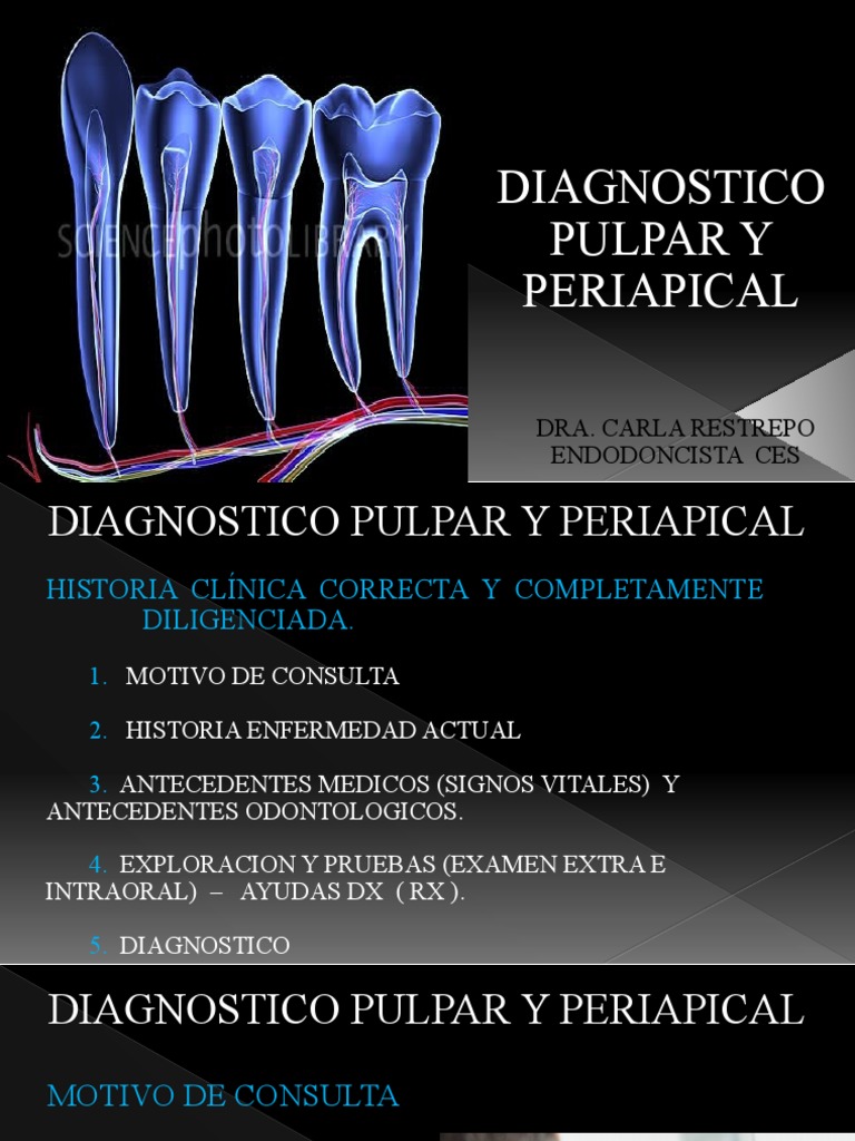 Dxtico Pulpar y Periapical | PDF | Especialidades Medicas | Medicina CLINICA