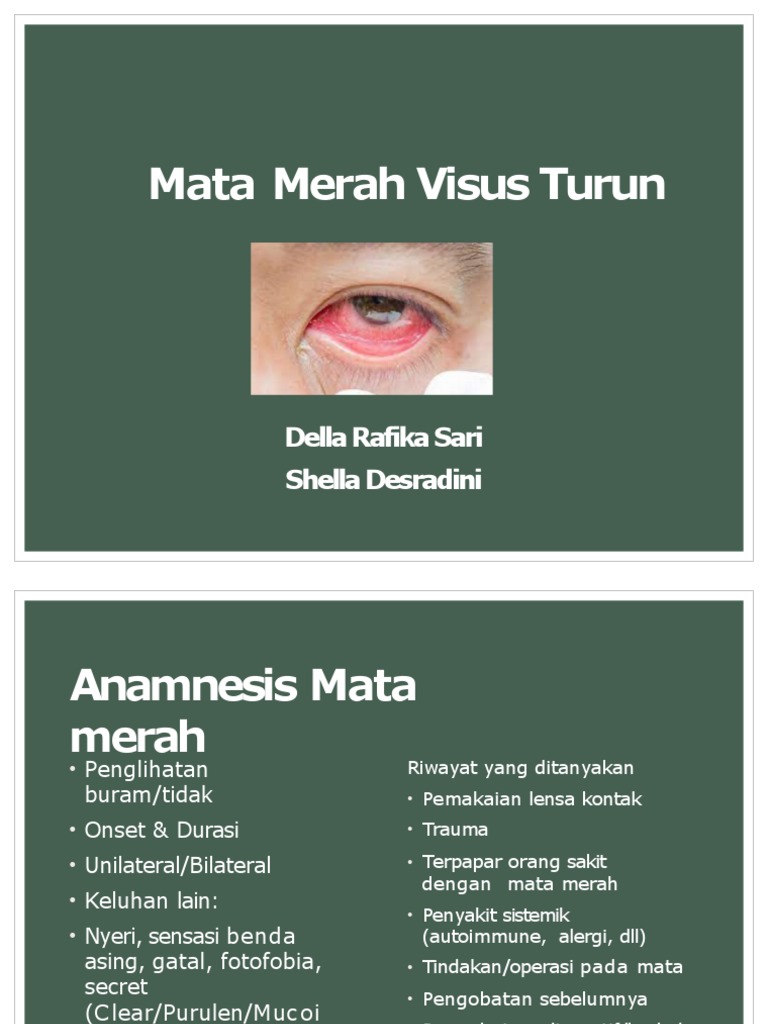 Mata Merah Visus Turun DELLA Dan SHELLA | PDF