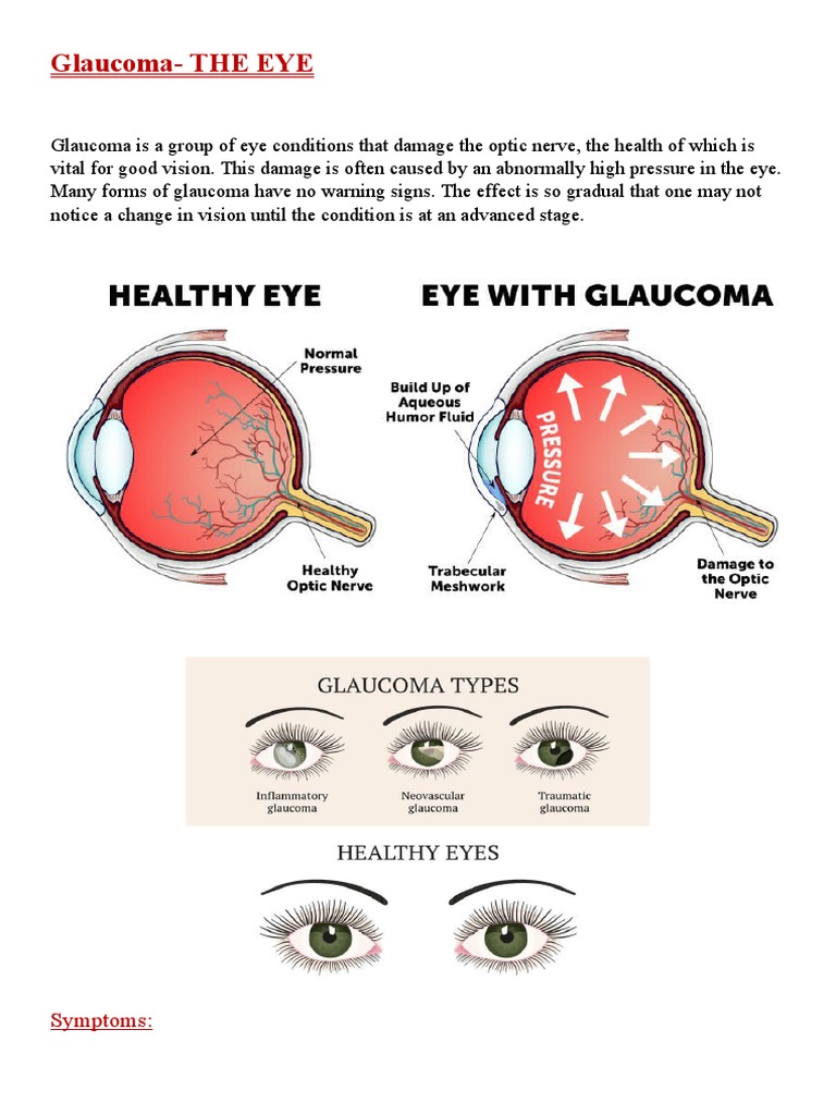 Biology - The Eye (Glaucoma) | Download Free PDF | Glaucoma | Vision