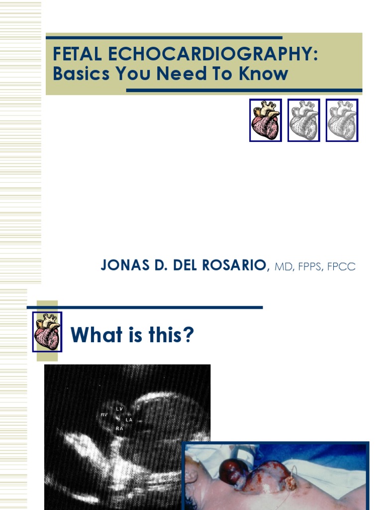 Basic Fetal Echocardiography | PDF | Congenital Heart Defect | Heart Valve