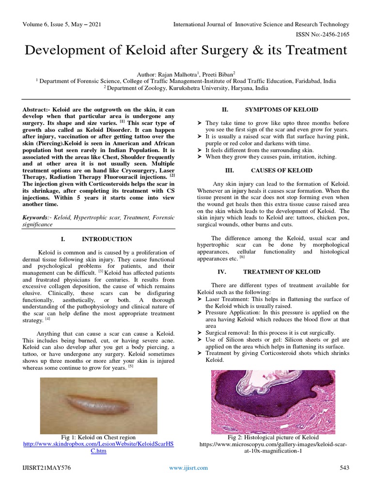 Development of Keloid After Surgery & Its Treatment | PDF | Scar ...