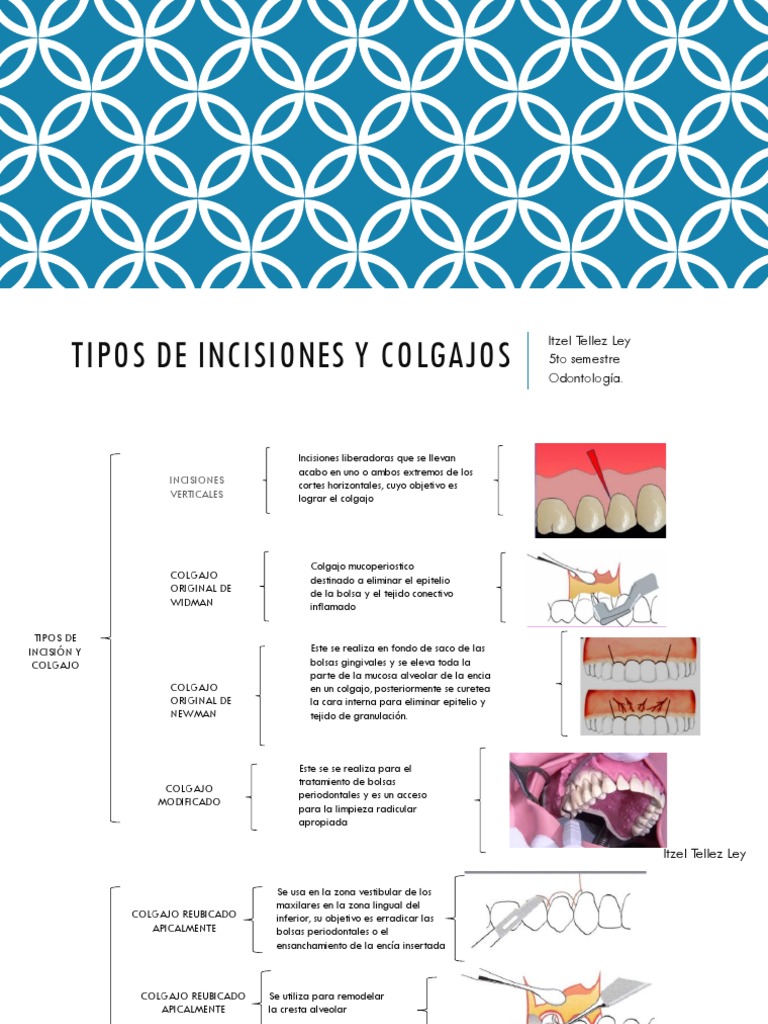 Tipos De Incisiones Y Colgajos Periodontales Pdf