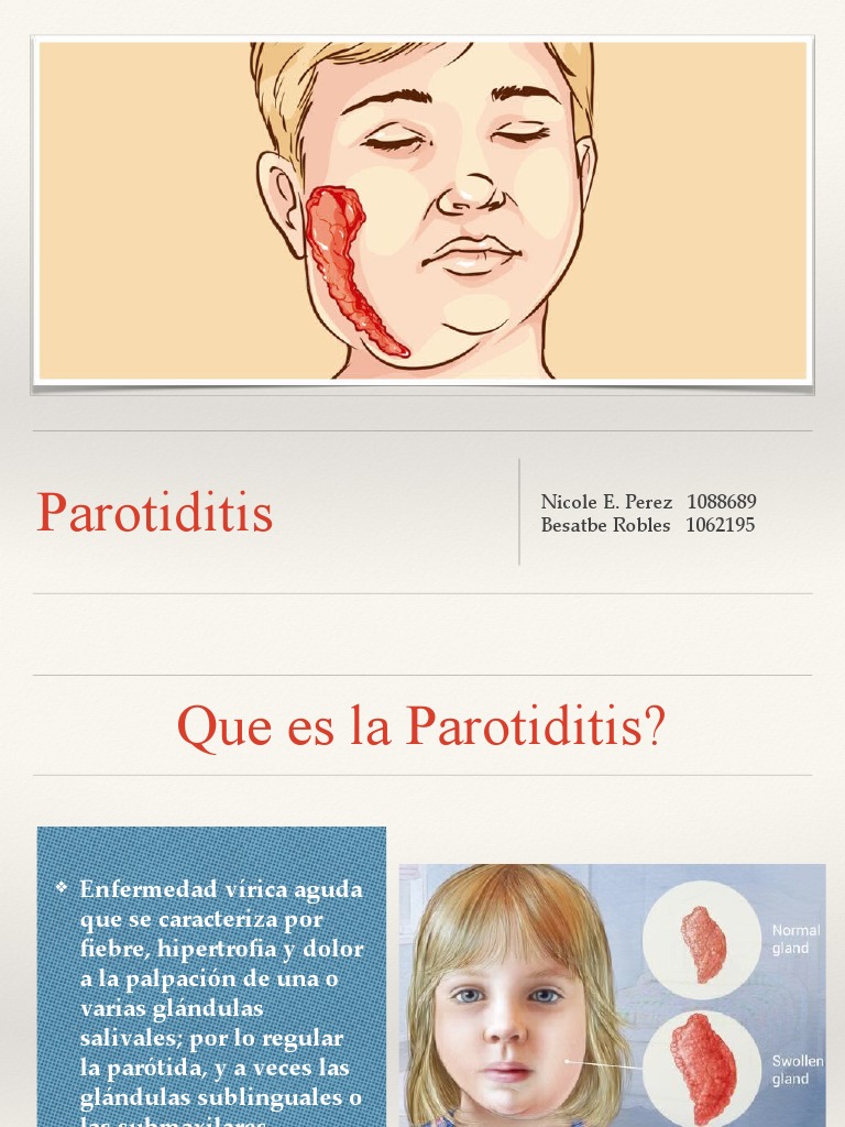 Parotiditis Micro2 | PDF | Virus | Enfermedades animales
