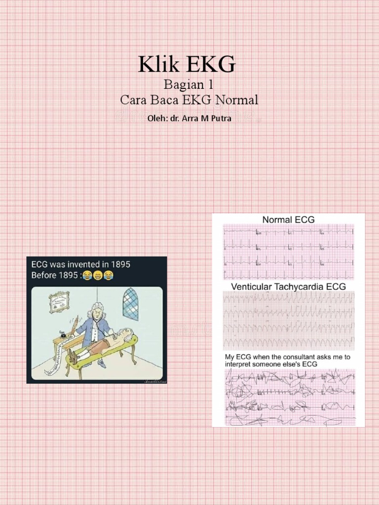 Panduan Membaca EKG Normal | PDF