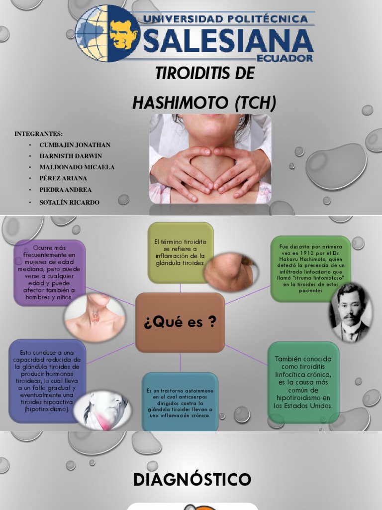 Tiroiditis de Hashimoto | PDF | Tiroides | Sistema inmune