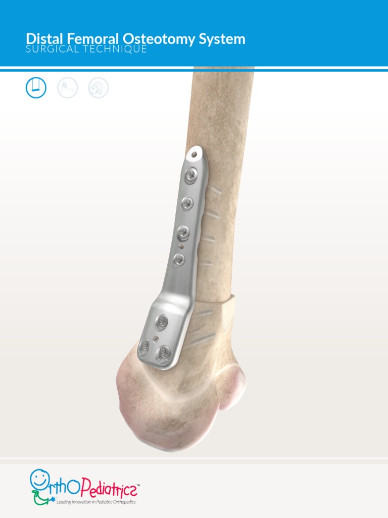 Distal Femoral Osteotomy System: Surgical Technique | PDF ...