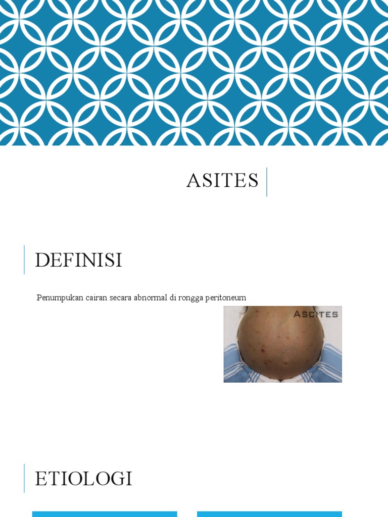 Diagnosis dan Terapi Asites Perut | PDF | Memasak, Makanan, & Anggur ...