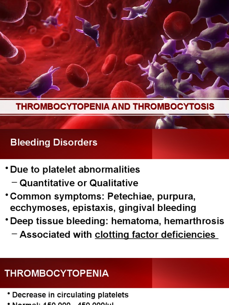 Week 16 Thrombocytopenia and Thrombocytosis SC | Platelet | Hematology