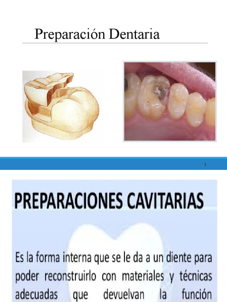 Procedimientos para la restauración dental: desde la preparación hasta ...