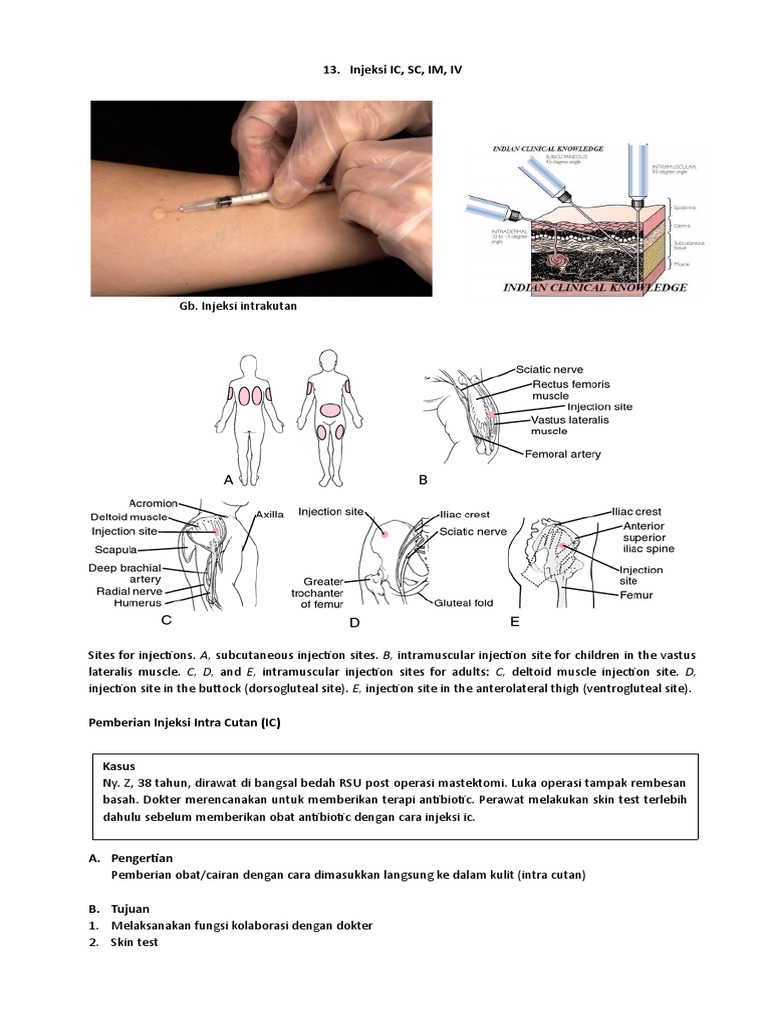 13 Pemberian Injeksi IC SC IM IV Edit Oke | PDF