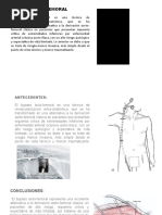 Guía de Procedimiento Lipoma | PDF | Cirugía | Causas de la muerte