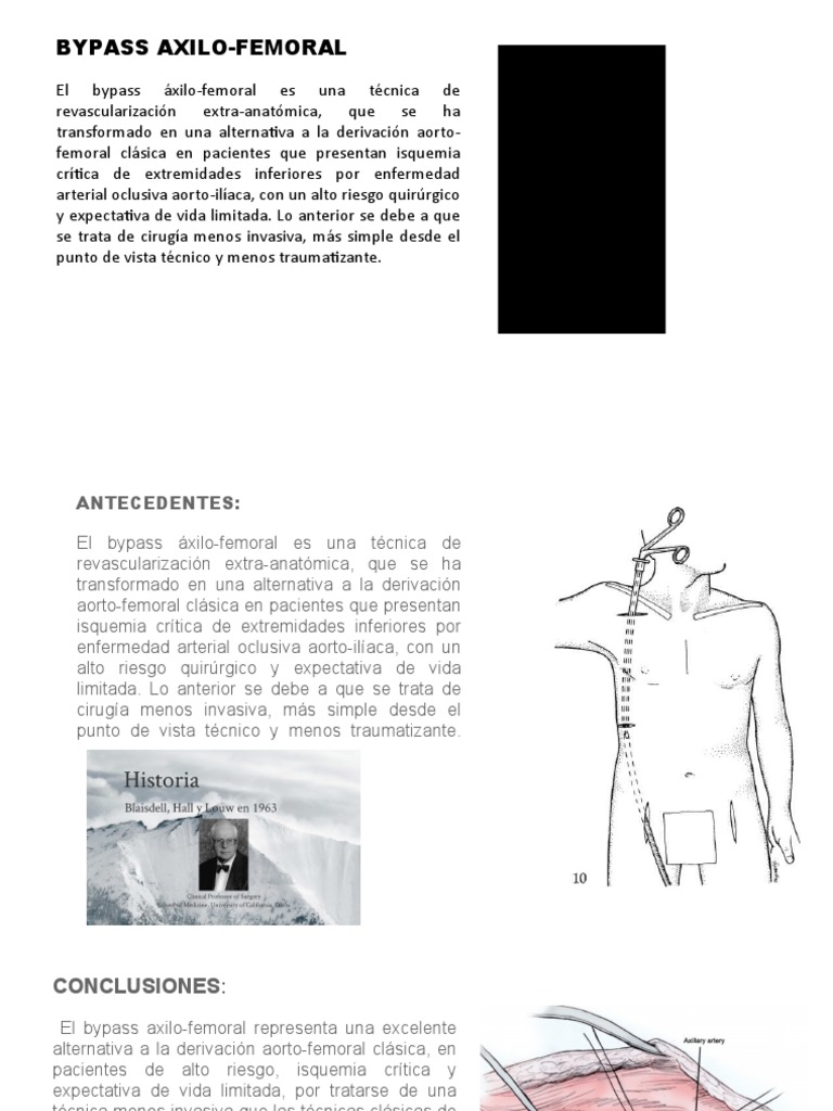 Bypass Axilo Femoral | PDF