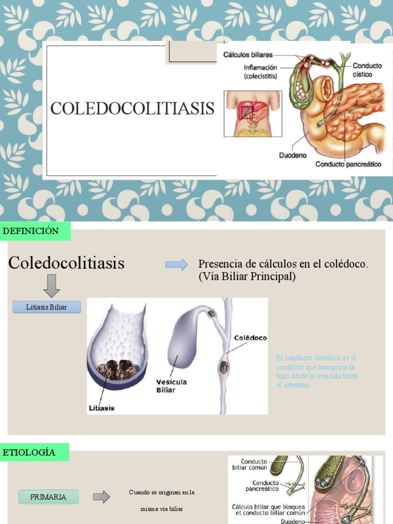 Coledocolitiasis Expo | PDF | Órgano (anatomía) | Sistema digestivo