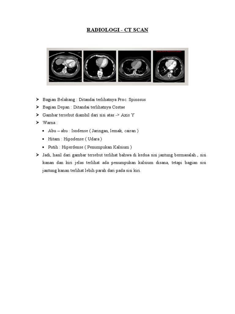 Analisis CT Scan Jantung | PDF | Seni | Sains & Matematika