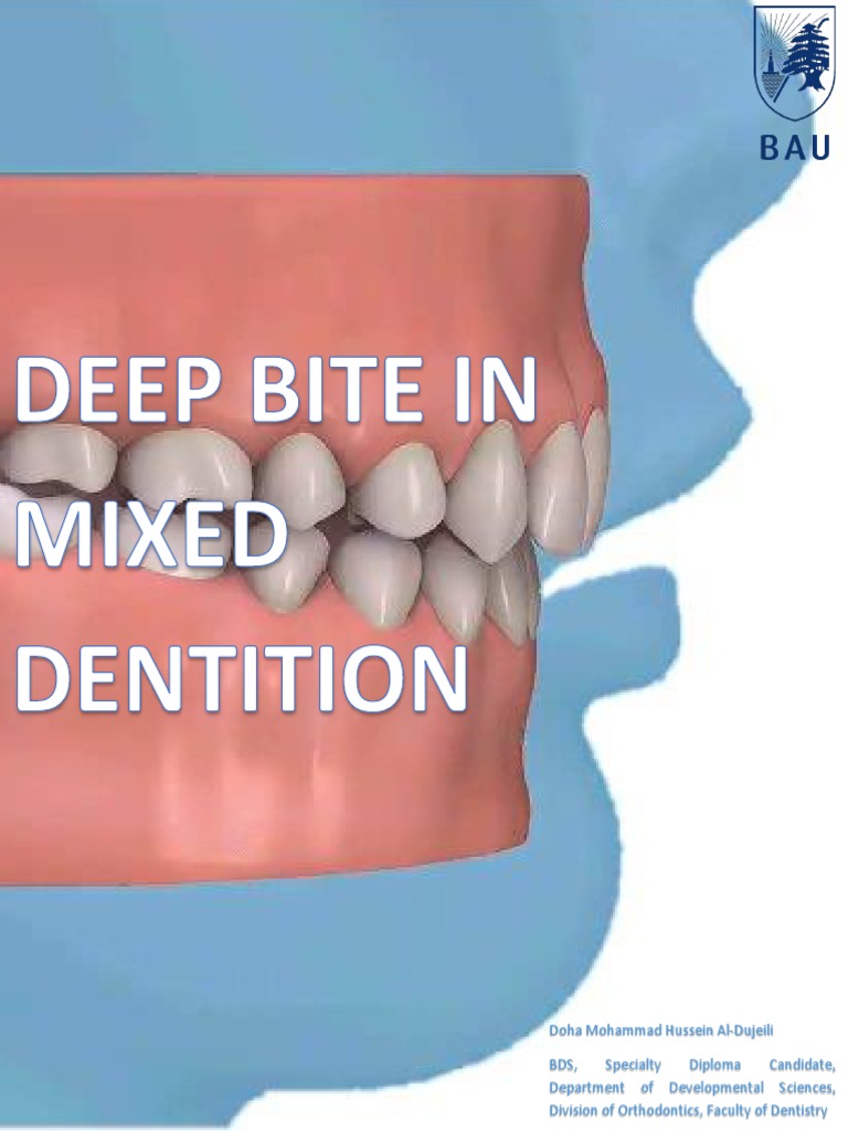 Deepbite | PDF | Face | Tooth