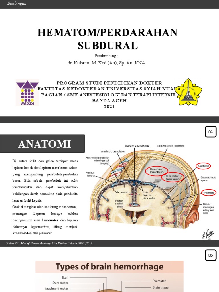 Bimbingan Hematom - Perdarahan Subdural | PDF