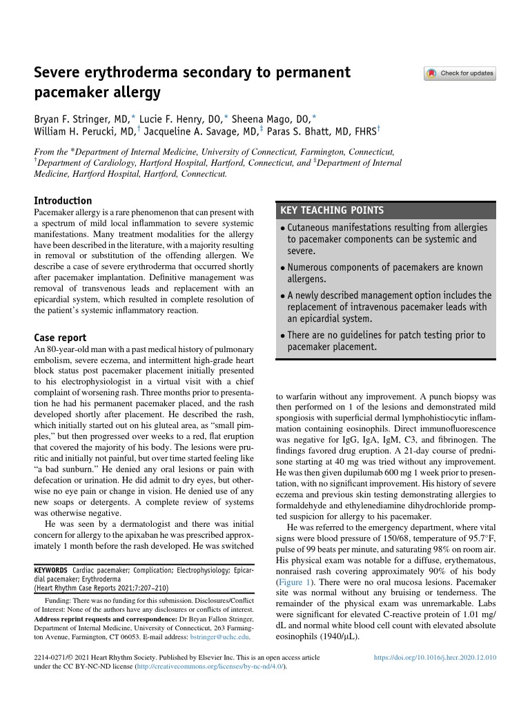 Severe Erythroderma Secondary To Permanent Pacemaker Allergy | PDF ...