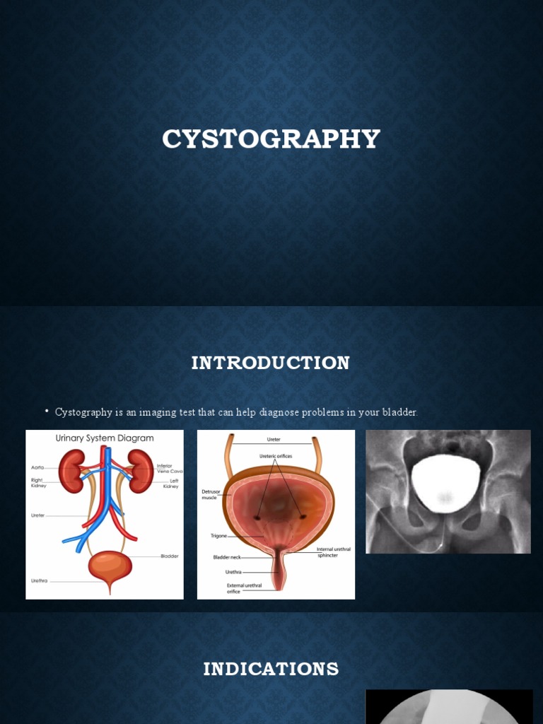 Cystography | PDF | Urinary Bladder | Urine