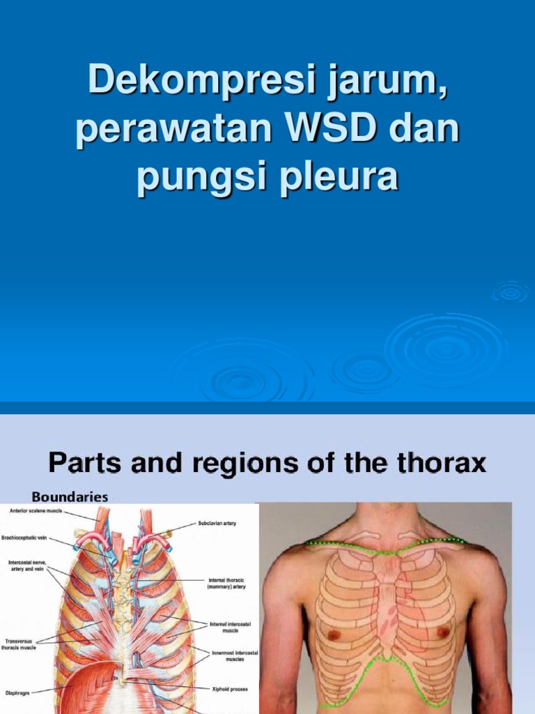 Decompressi WSD Efusi Pleura | PDF Decompressi WSD Efusi Pleura | PDF