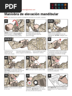 Protocolo MARCH en Medicina Táctica | PDF | Reanimación cardiopulmonar ...