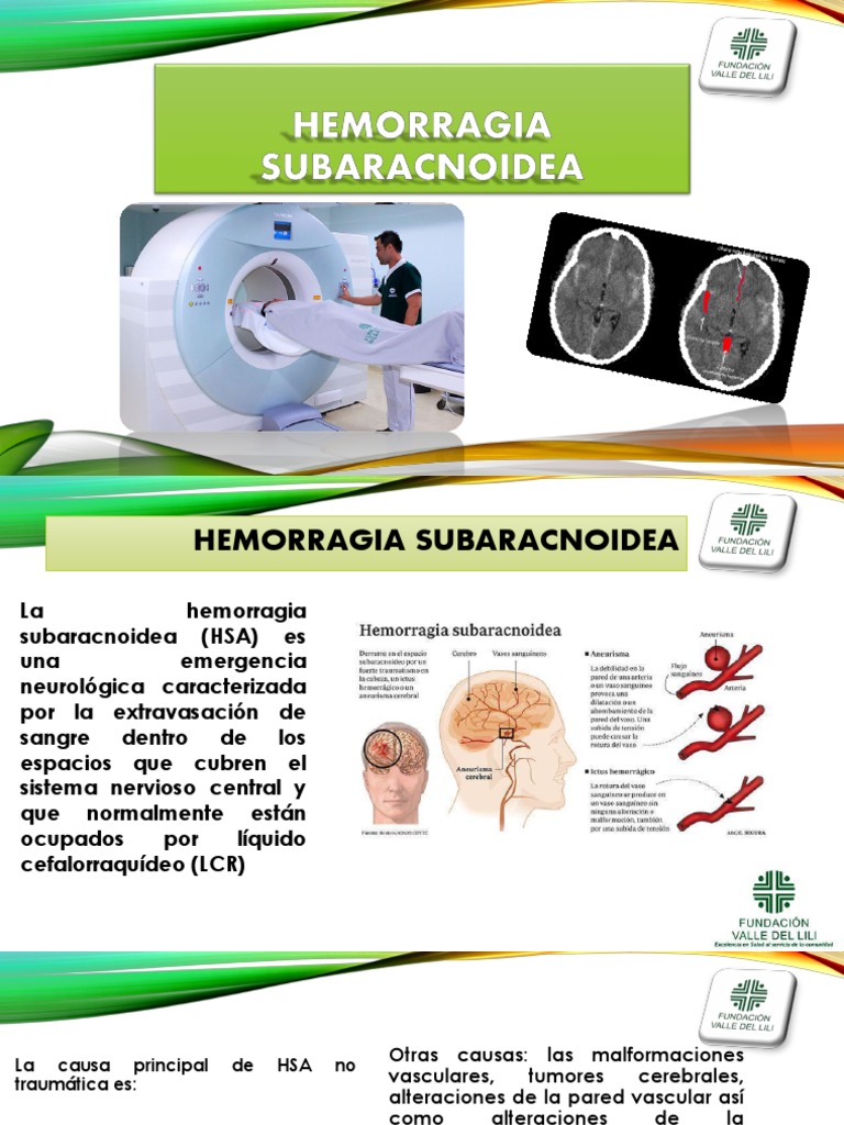 Hemorragia Subaracnoidea | PDF | Angiología | Especialidades Medicas