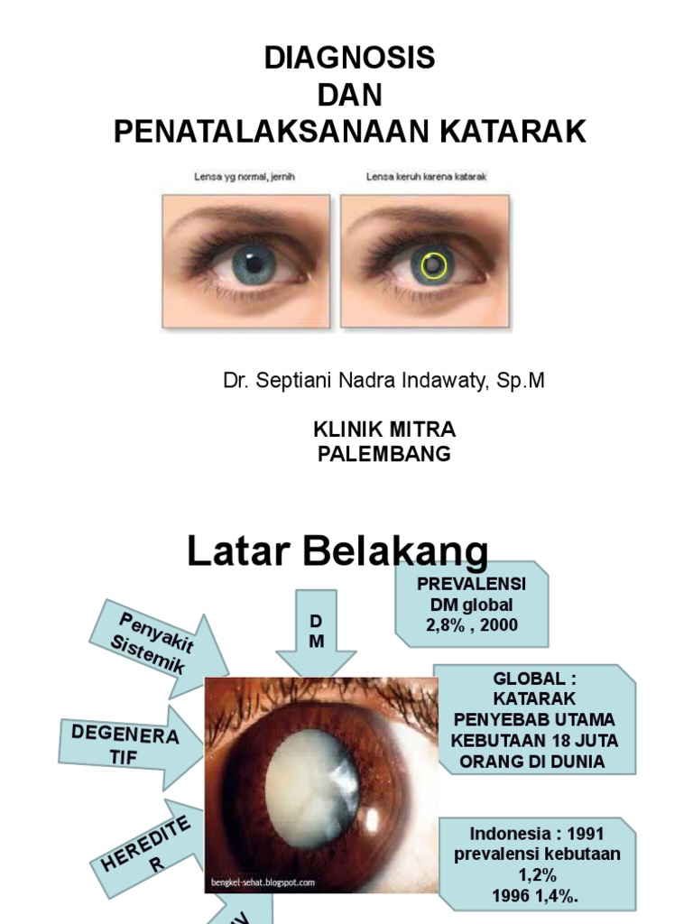 Diagnosis Dan Penatalaksanaan Katarak | PDF