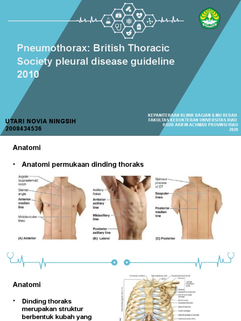 Pneumothorax Bts | PDF