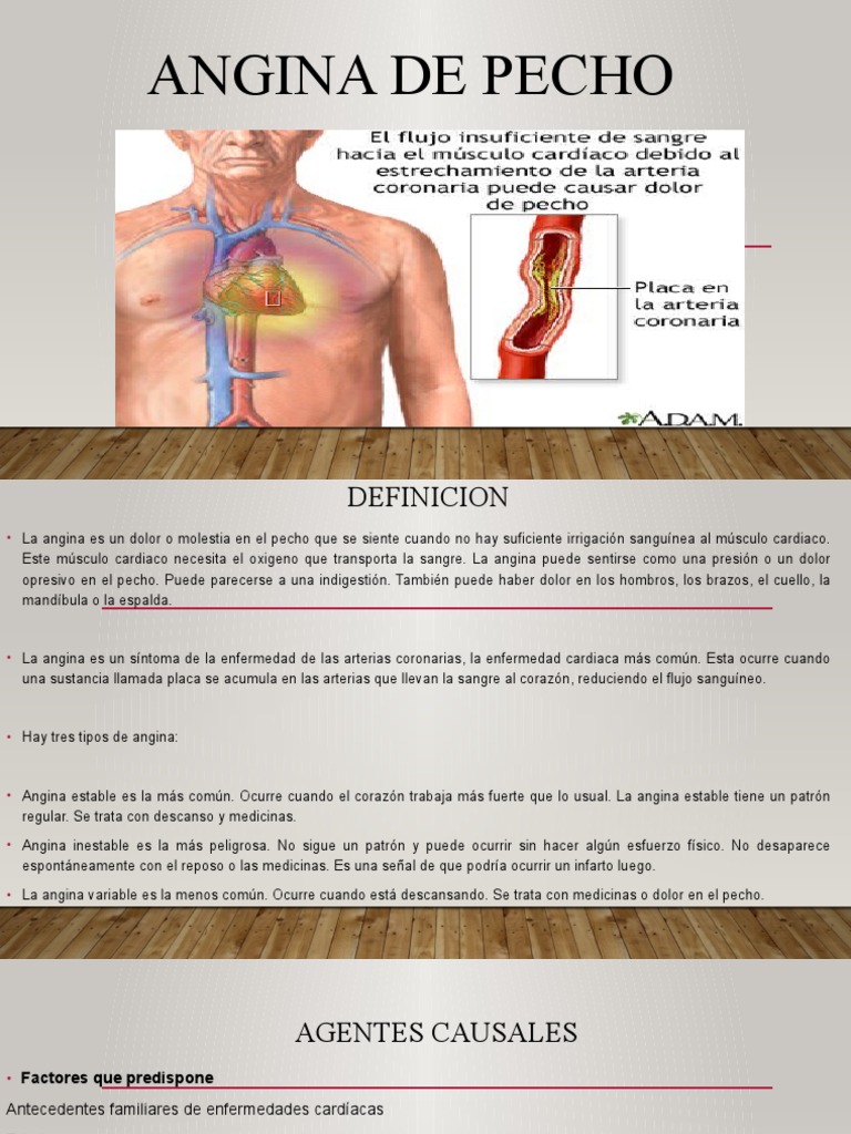 Angina de Pecho | PDF | Angiografía | Corazón