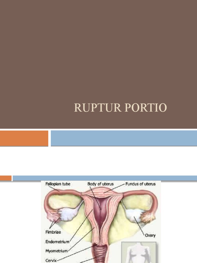 Ruptur Portio | PDF