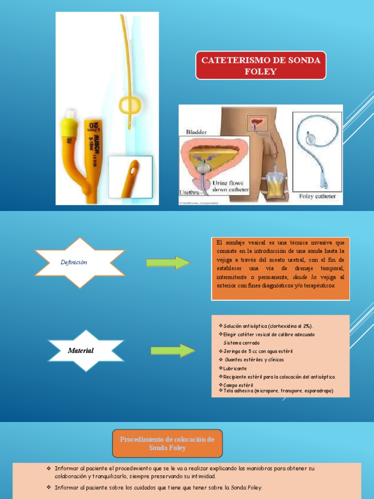 Sonda Foley Expo. | PDF | Vejiga urinaria | Lavado de manos