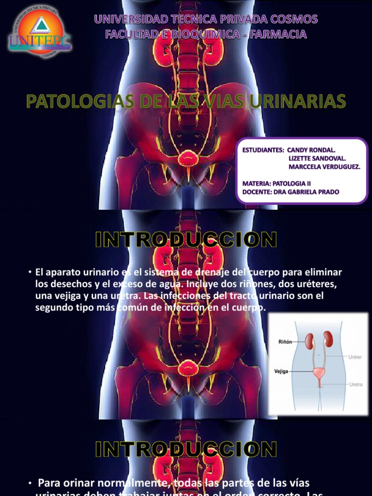 Patologia Urinarias | Descargar gratis PDF | Infección del tracto ...